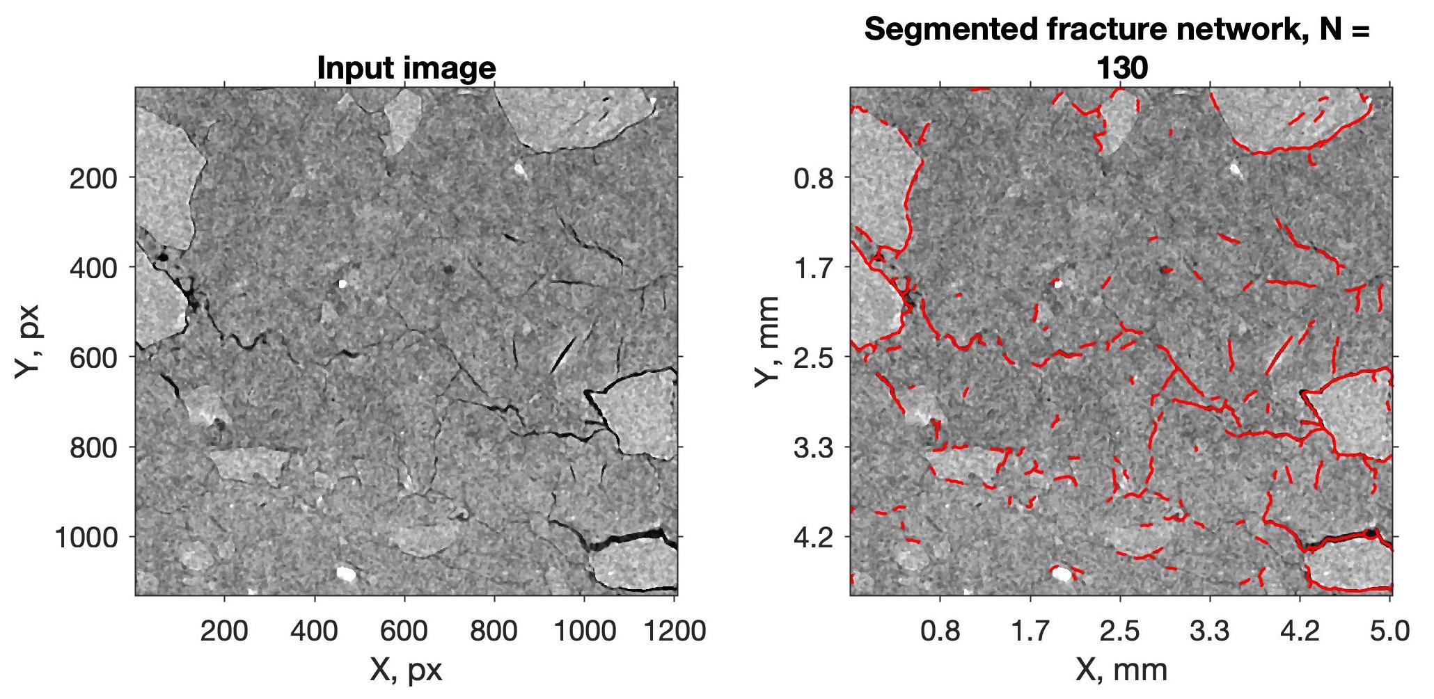Fracture Segmentation